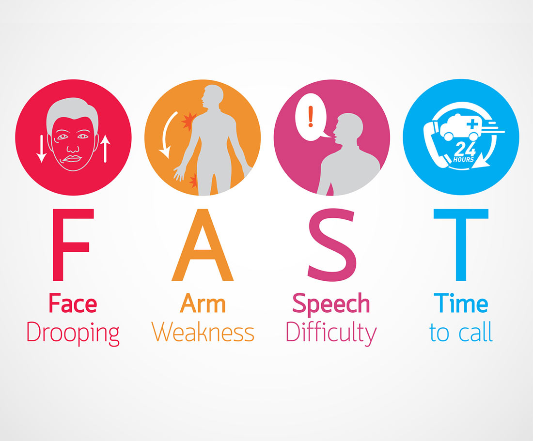 Stroke: Know the signs